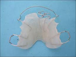 Những điều cần biết về chỉnh hình răng miệng - Nha khoa Đăng Lưu