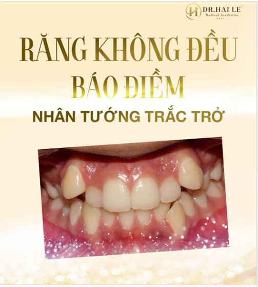 HÀM RĂNG KHÔNG ĐỀU TRONG NHÂN TƯỚNG HỌC NÓI LÊN ĐIỀU GÌ