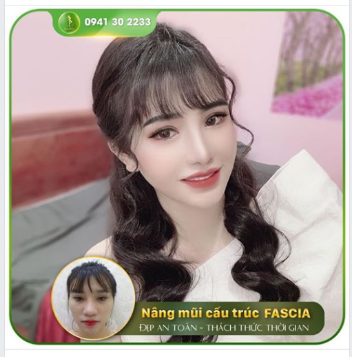 ĐẸP THẾ NÀY ĐÃ ĐỦ THUYẾT PHỤC BẠN LỰA CHỌN SÀI GÒN VENUS CHƯA