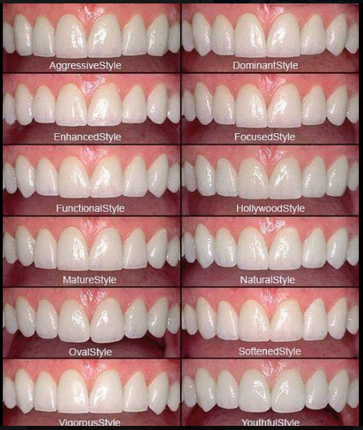Bạn có biết có tổng cộng bao nhiêu form răng cơ bản?