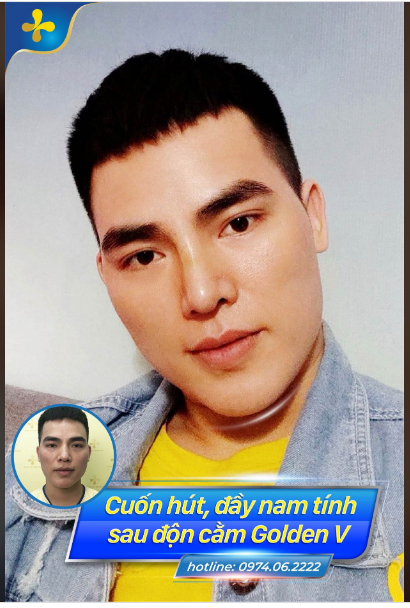 Gương mặt V Line được xem là chuẩn mực của vẻ đẹp hiện đại mà rất nhiều ...