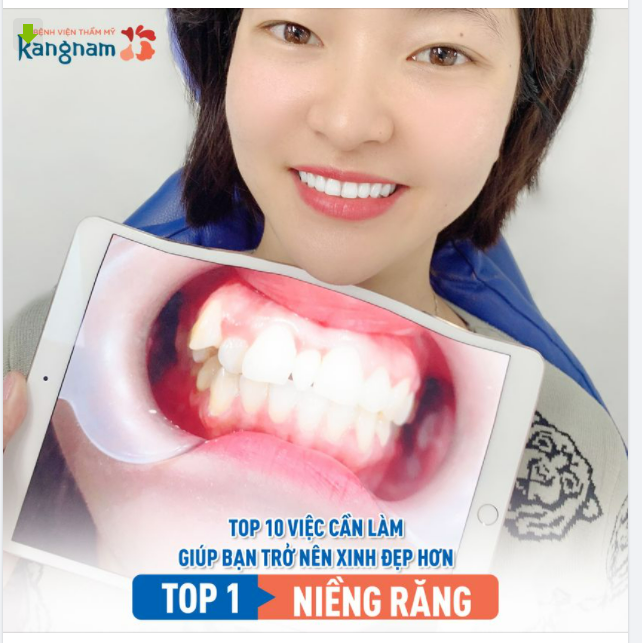 Hơn 20 năm thanh xuân, đến miếng bánh quy cũng phải cắn bằng răng hàm ...