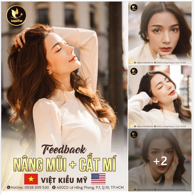 FEEDBACK COMBO NÂNG MŨI + CẮT MÍ TỪ VIỆT KIỀU MỸ