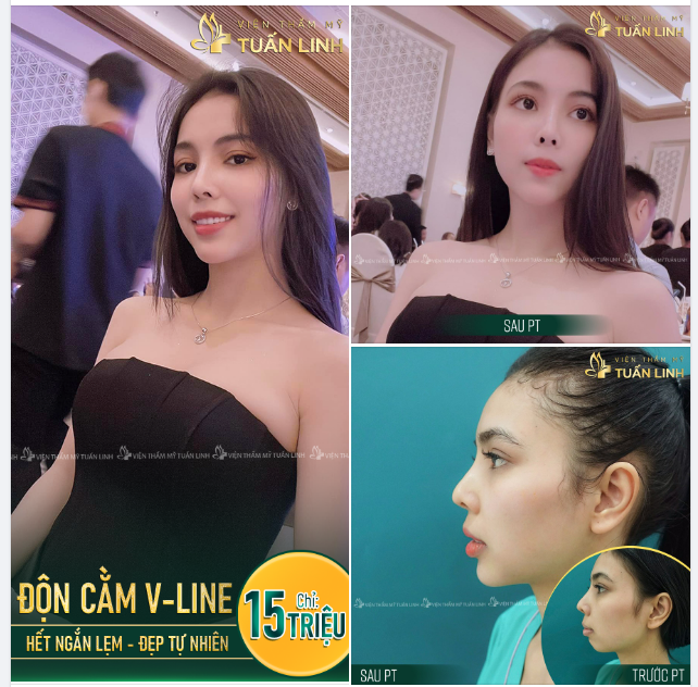 ĐỘN CẰM VLINE - ĐẸP TỰ NHIÊN