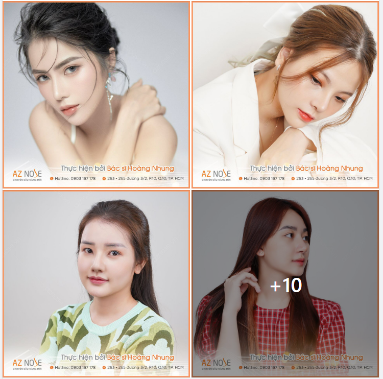 Nhìn lại những dáng mũi đẹp tự nhiên và giữ được nét trẻ trung do Bác ...