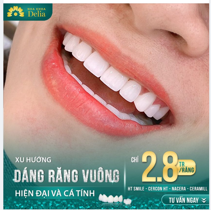 Thẩm mỹ răng sứ dáng răng vuông - Form răng tinh tế được ưa chuộng tại ...