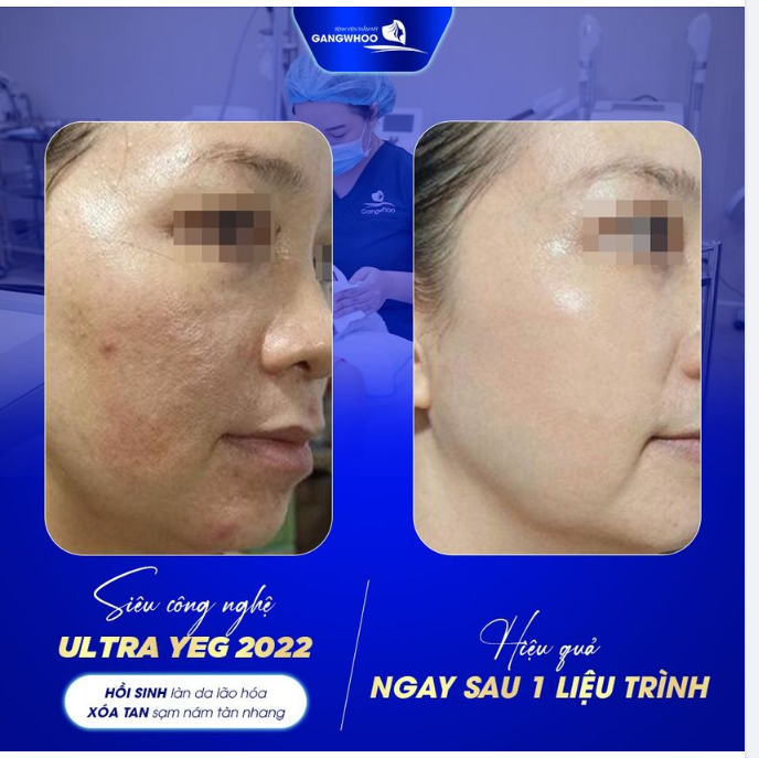 CHÌA KHÓA VÀNG TRỊ NÁM SỐ 1 HIỆN NAY