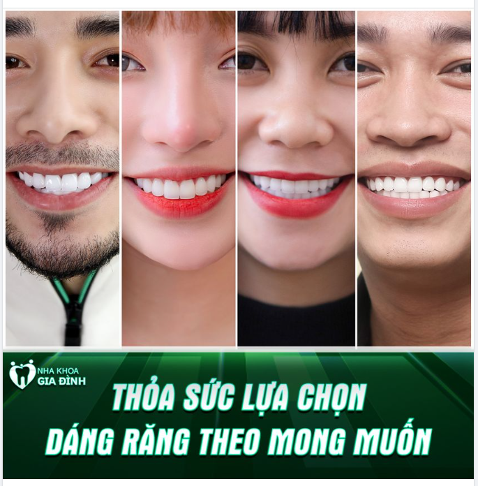 CHỌN DÁNG RĂNG - KHOE TÍNH CÁCH
