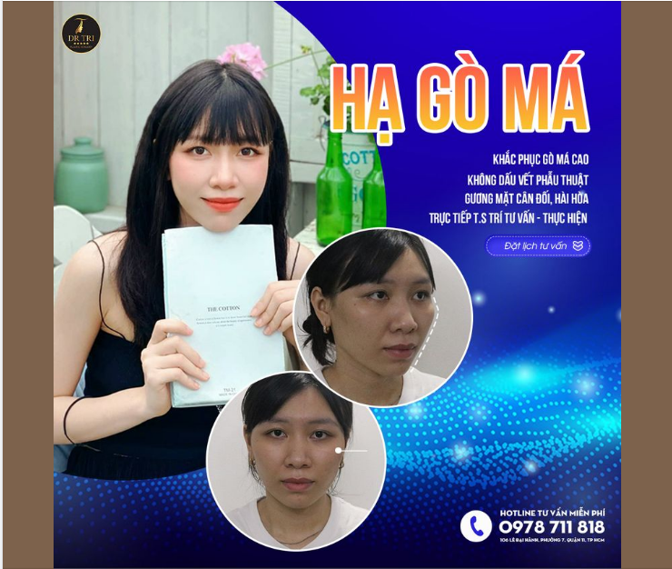 GƯƠNG MẶT XINH ĐẸP SAU 6 THÁNG HẠ GÒ MÁ của CÔ NÀNG TIKTOKER
