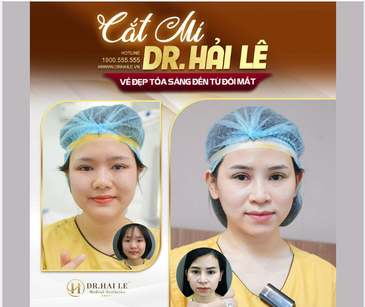 MÍ ĐẸP MẮT XINH - CÀNG NGẮM CÀNG MÊ