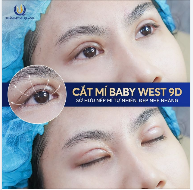 Mí đẹp mắt xinh - Lung linh ánh nhìn