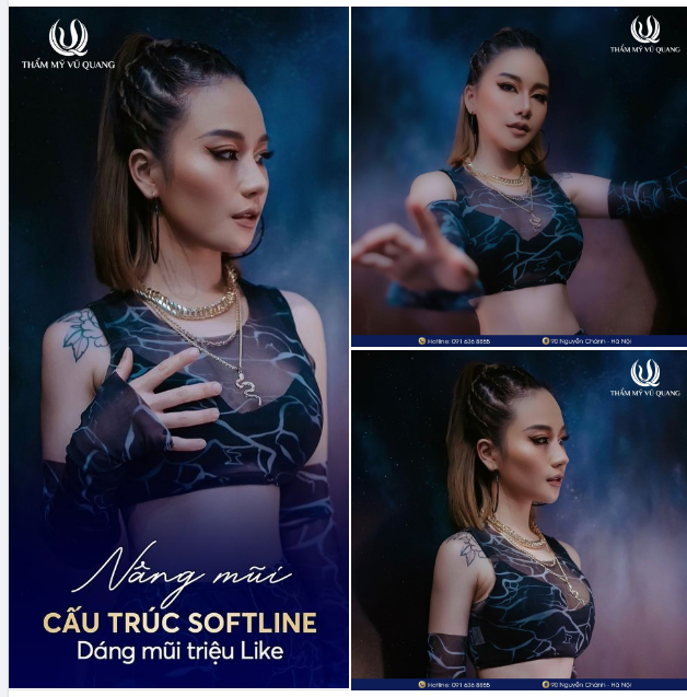 Nâng mũi cấu trúc Softline - Mũi đẹp triệu like - Ai ai cũng thích