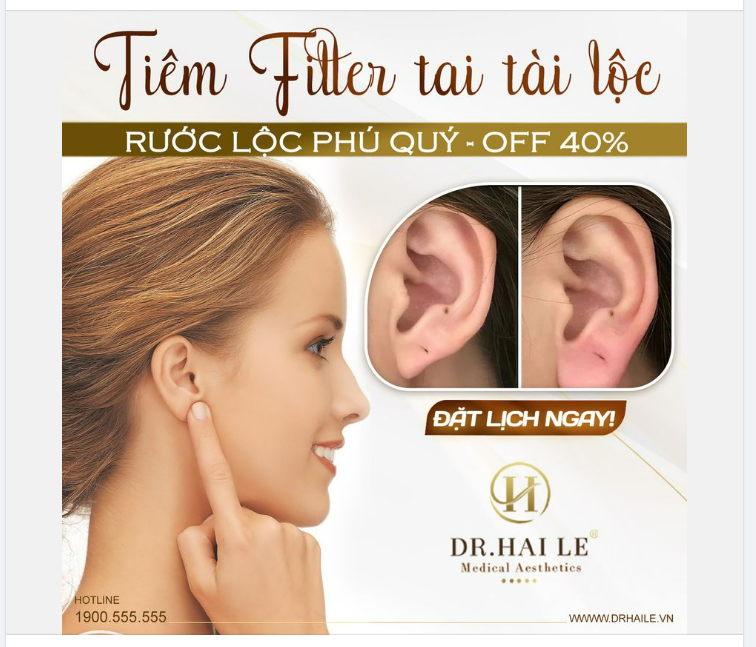 Tiêm filler tai tài lộc - Đẹp chuẩn phong thủy có như LỜI ĐỒN