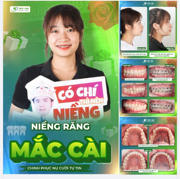 TUỔI TRẺ LÀ DÁM LÀM, DÁM CHƠI, DÁM THAY ĐỔI VÀ DÁM NIỀNG RĂNG!