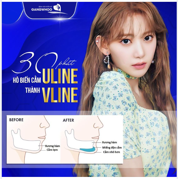 HÔ BIẾN CẰM ULINE THÀNH VLINE CHỈ SAU 30 PHÚT ĐỘN CẰM