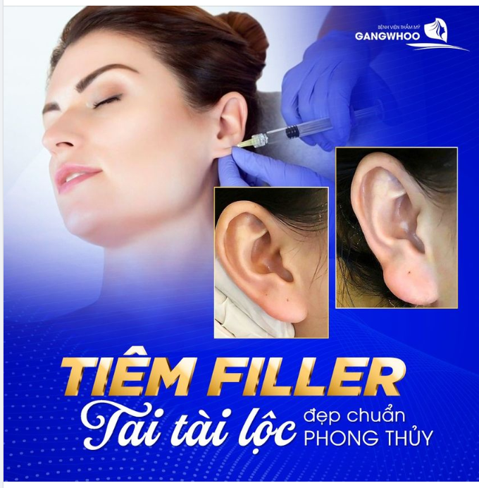 TIÊM FILLER TAI TÀI LỘC RƯỚC LỘC PHÚ QUÝ - TÀI LỘC DỒI DÀO