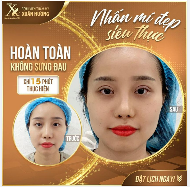 NHẤN MÍ ĐẸP SIÊU THỰC SAU 15 PHÚT, XINH ĐẸP CHỈ VỚI CAN THIỆP NHỎ
