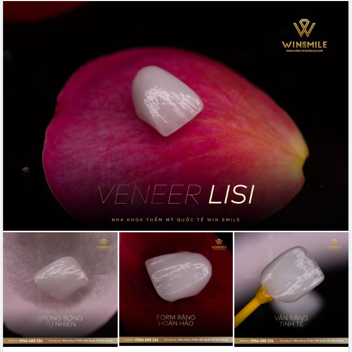 Form răng thẩm mỹ được thiết kế thời thượng nhưng vẫn giữ được tính cá ...