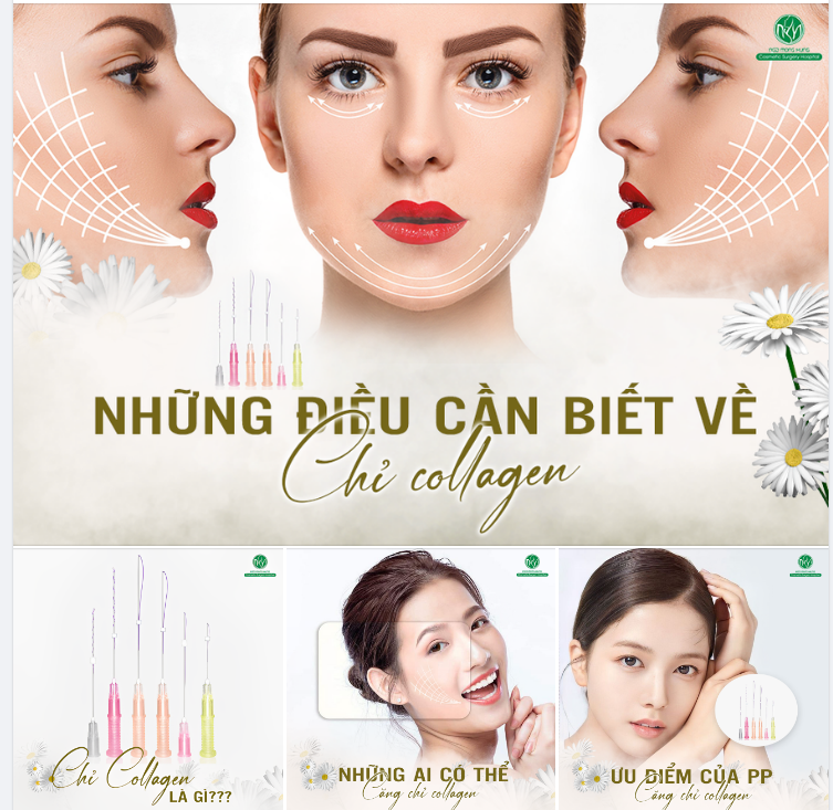NHỮNG ĐIỀU CẦN BIẾT VỀ CHỈ COLLAGEN TRONG PT CĂNG DA MẶT