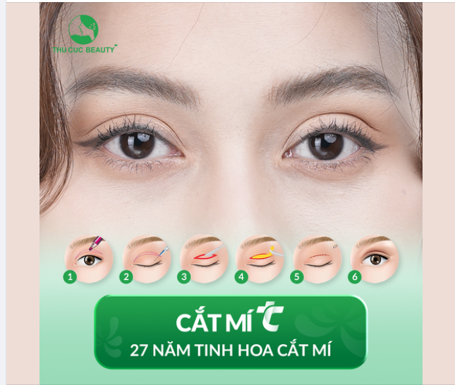 Tư vấn cắt mí từ A - Z cùng Thu Cuc