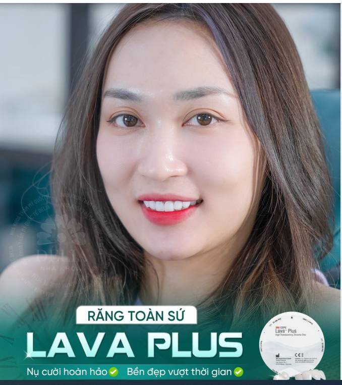 Răng toàn sứ Lava Plus Siêu phẩm kiến tạo nụ cười hoàn hảo - bền đẹp ...