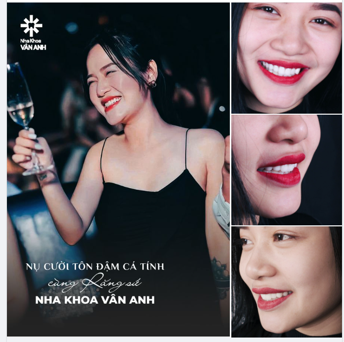 Với form răng được thiết kế độc quyền bởi các chuyên gia tại Nha Khoa ...