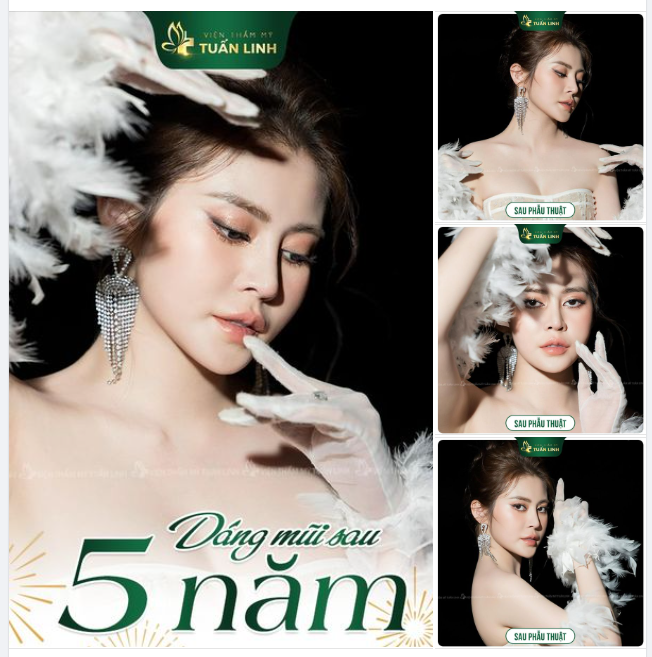 Pic này sẽ cho bạn thấy thế nào gọi là dáng mũi bền đẹp dài lâu!