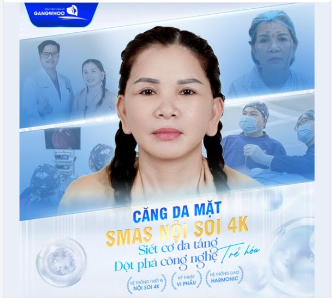 CĂNG DA MẶT SMAS NỘI SOI 4K SIẾT CƠ ĐA TẦNG ĐỘT PHÁ CÔNG NGHỆ TRẺ HÓA