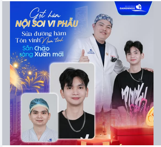 GỌT HÀM NỘI SOI VI PHẪU SỬA ĐƯỜNG HÀM TÔN VINH NÉT ĐẸP NAM THẦN