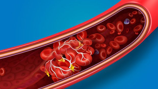 Thuốc Jantoven: Công dụng, chỉ định và lưu ý khi dùng - Bệnh viện Vinmec